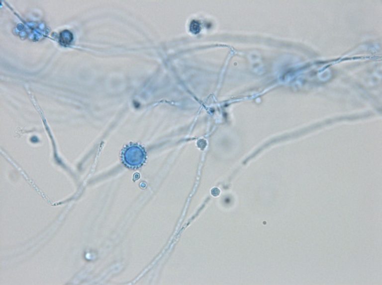 Dimorphic fungi - Life Worldwide