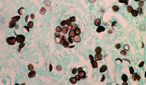 Dimorphic fungi - Life Worldwide