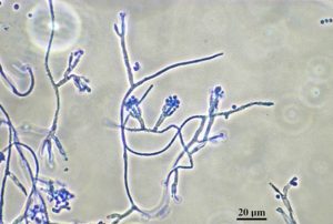 Dimorphic fungi - Life Worldwide