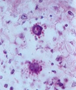 Dimorphic fungi - Life Worldwide