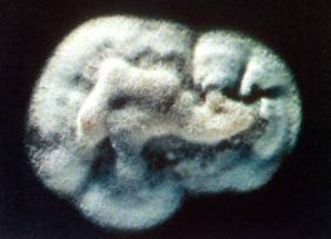 Dimorphic fungi - Life Worldwide