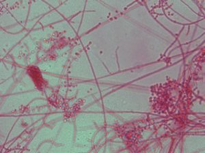 Trichophyton spp. - Life Worldwide
