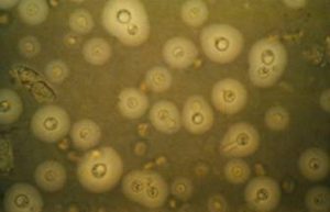 Direct microscopy of fungi - Life Worldwide