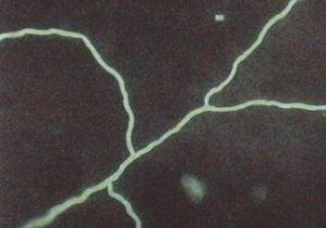 Trichophyton spp. - Life Worldwide