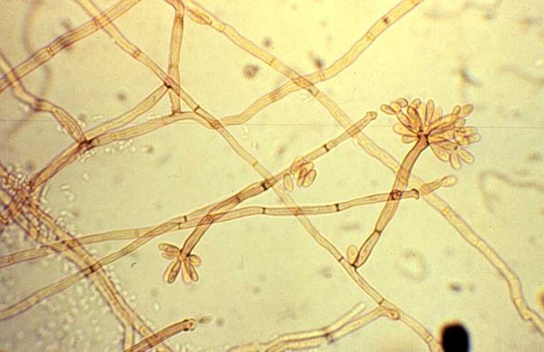 Filamentous fungi - Life Worldwide