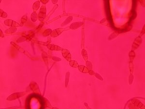 Filamentous fungi - Life Worldwide