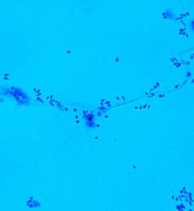 Trichophyton spp. - Life Worldwide